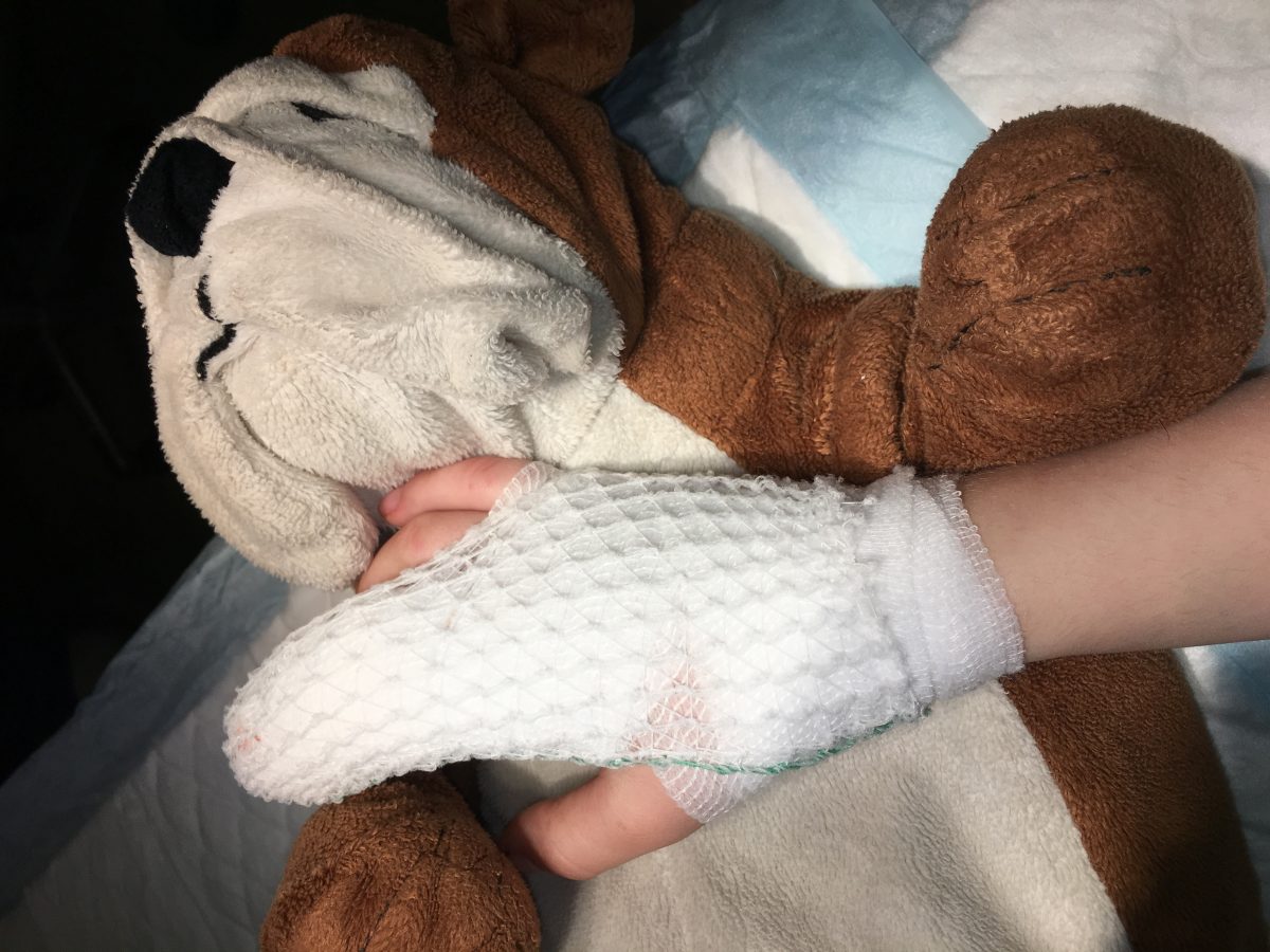 pansement-plaie-main | L'institut de chirurgie de la main de l'ouest ...